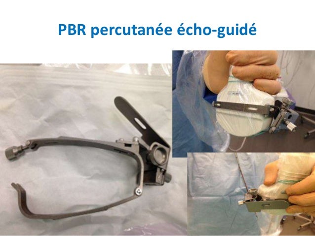 La Ponction biopsie rénale