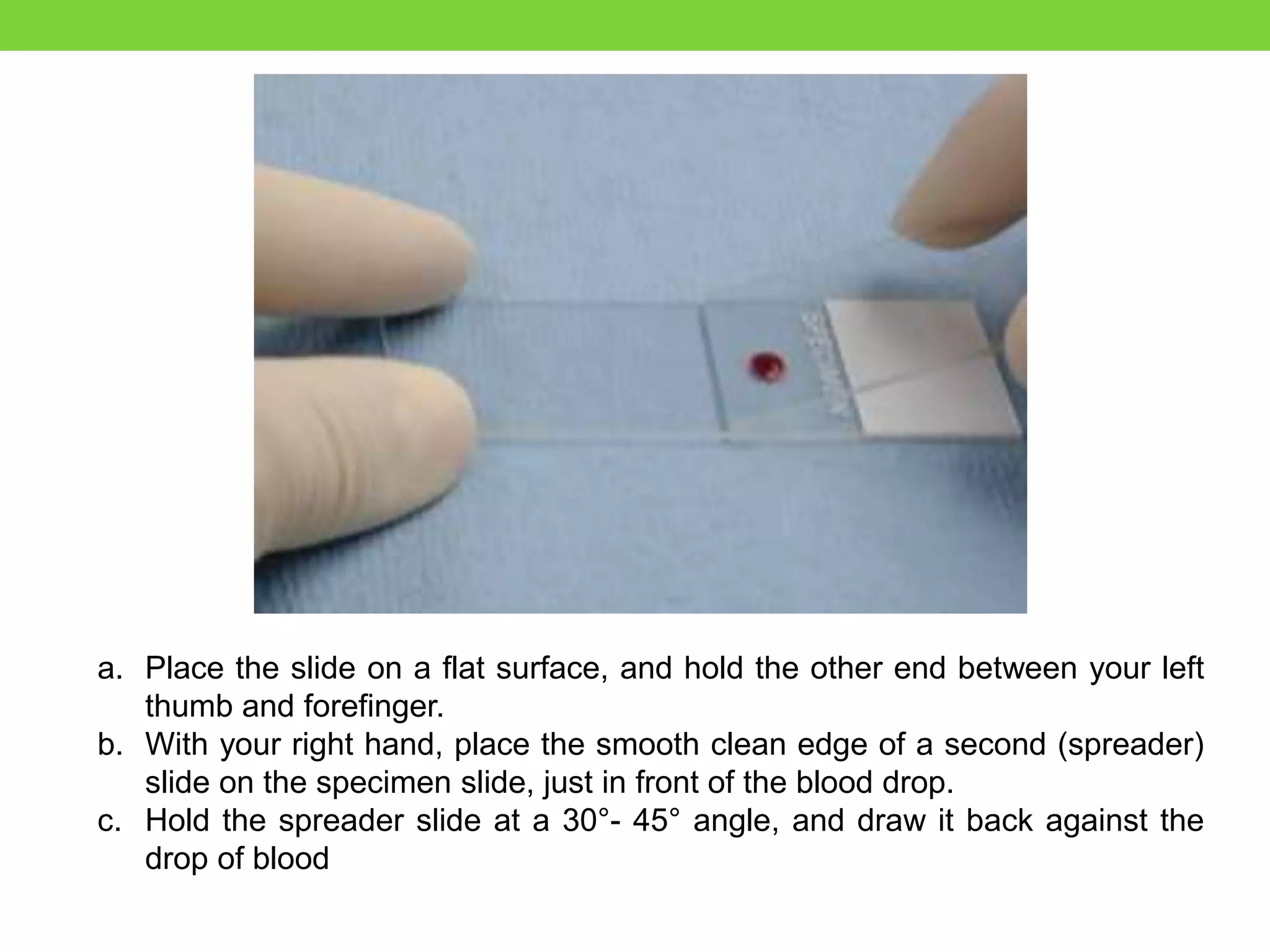 Peripheral Blood Smear Examination | PPTX