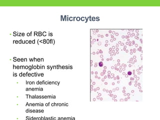 Peripheral Blood Smear Examination | PPTX