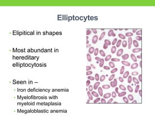 Peripheral Blood Smear Examination | PPTX