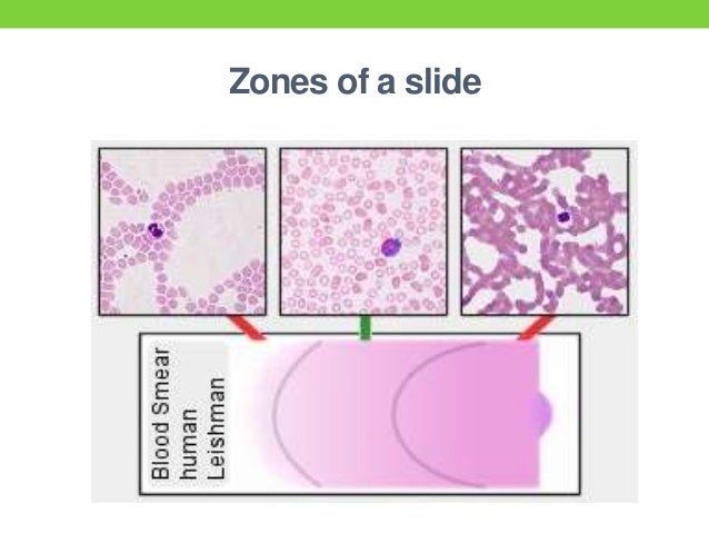 Peripheral Blood Smear Examination