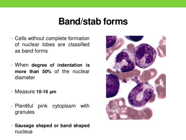 Peripheral Blood Smear Examination