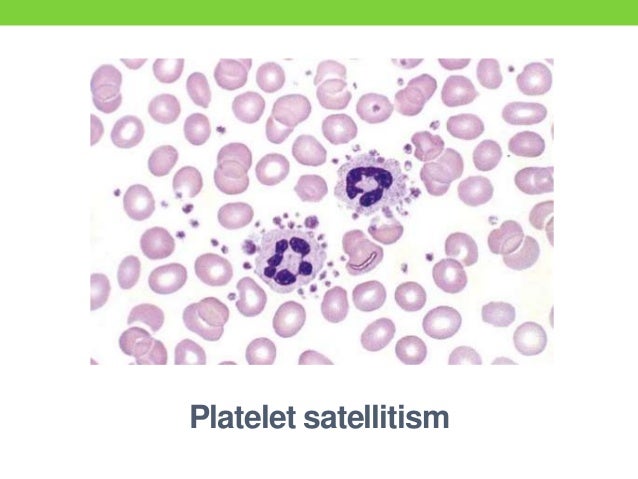 Peripheral Blood Smear Examination