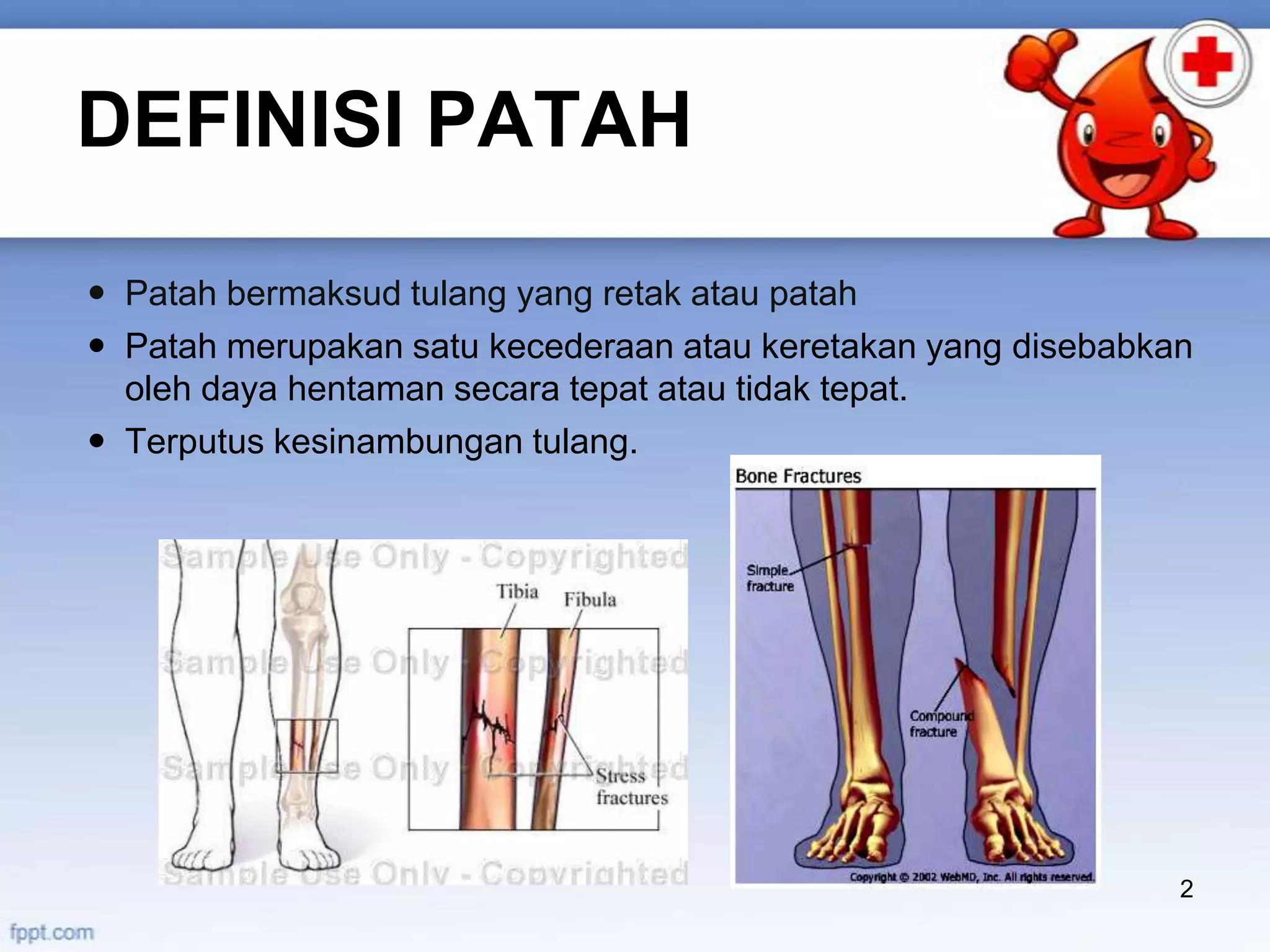 PBSM 2012 patah dan terseliuh | PPTX