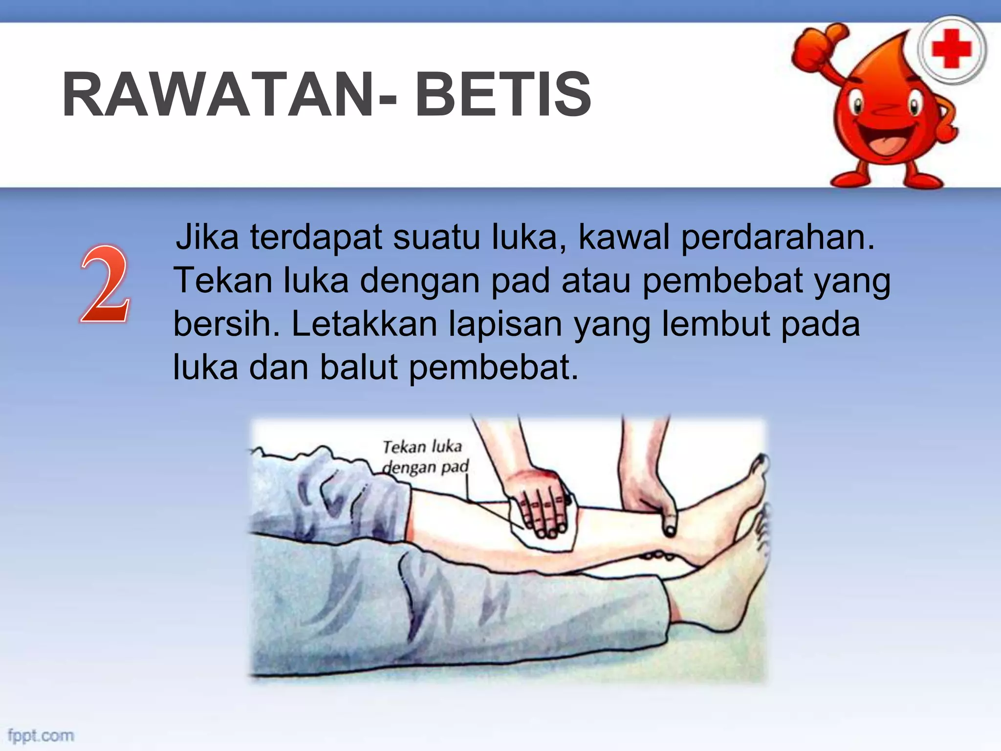 PBSM 2012 patah dan terseliuh | PPTX