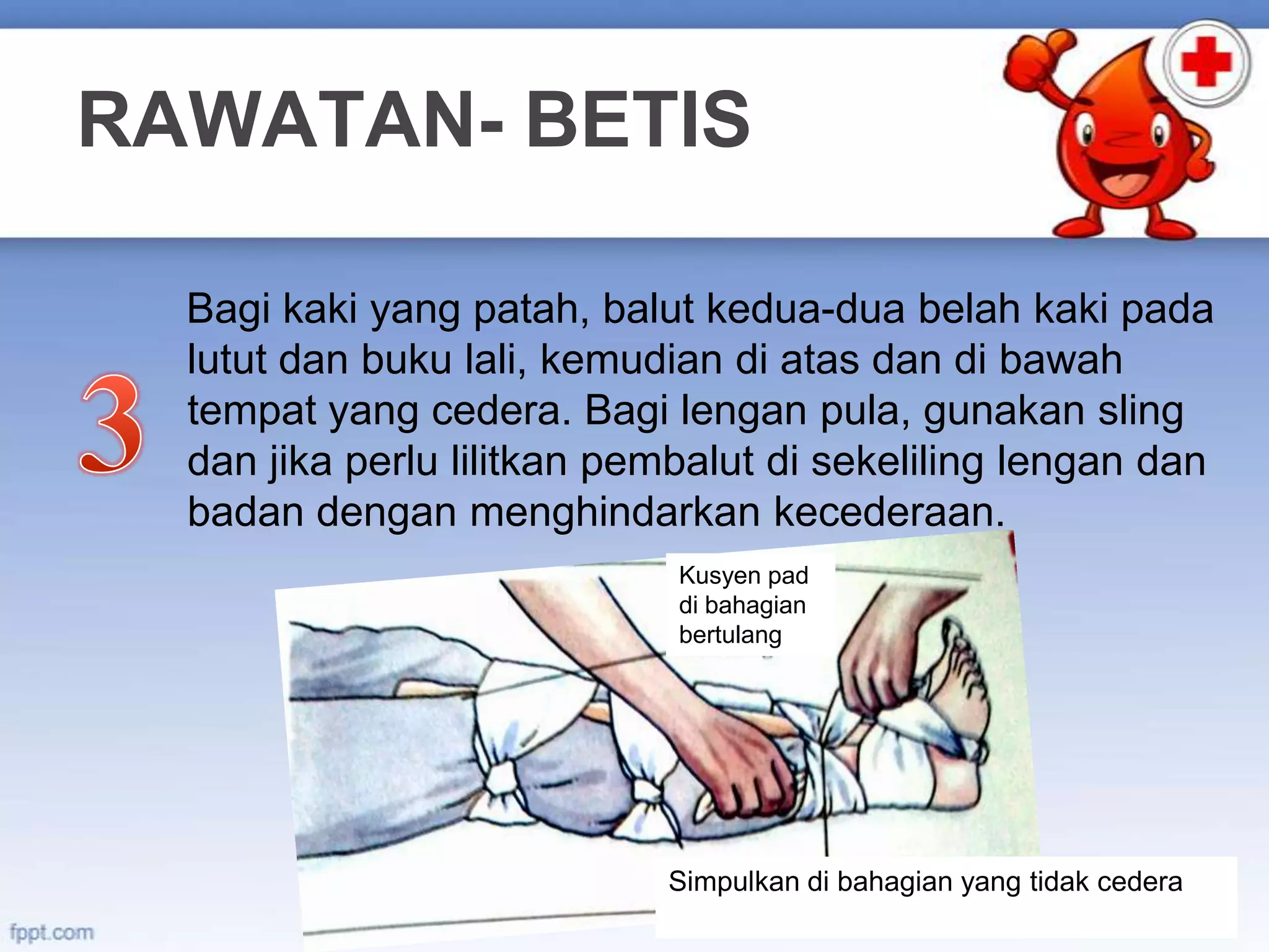 PBSM 2012 patah dan terseliuh | PPTX