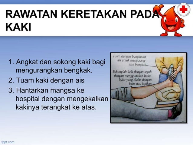 PBSM 2012 patah dan terseliuh | PPTX