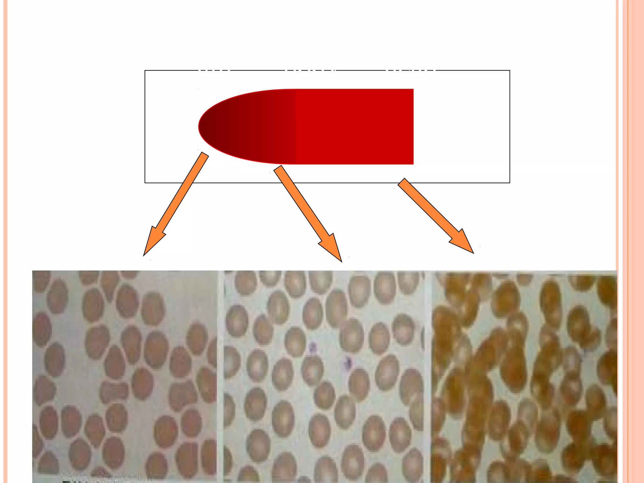 Peripheral blood Smear Preparation | PPT