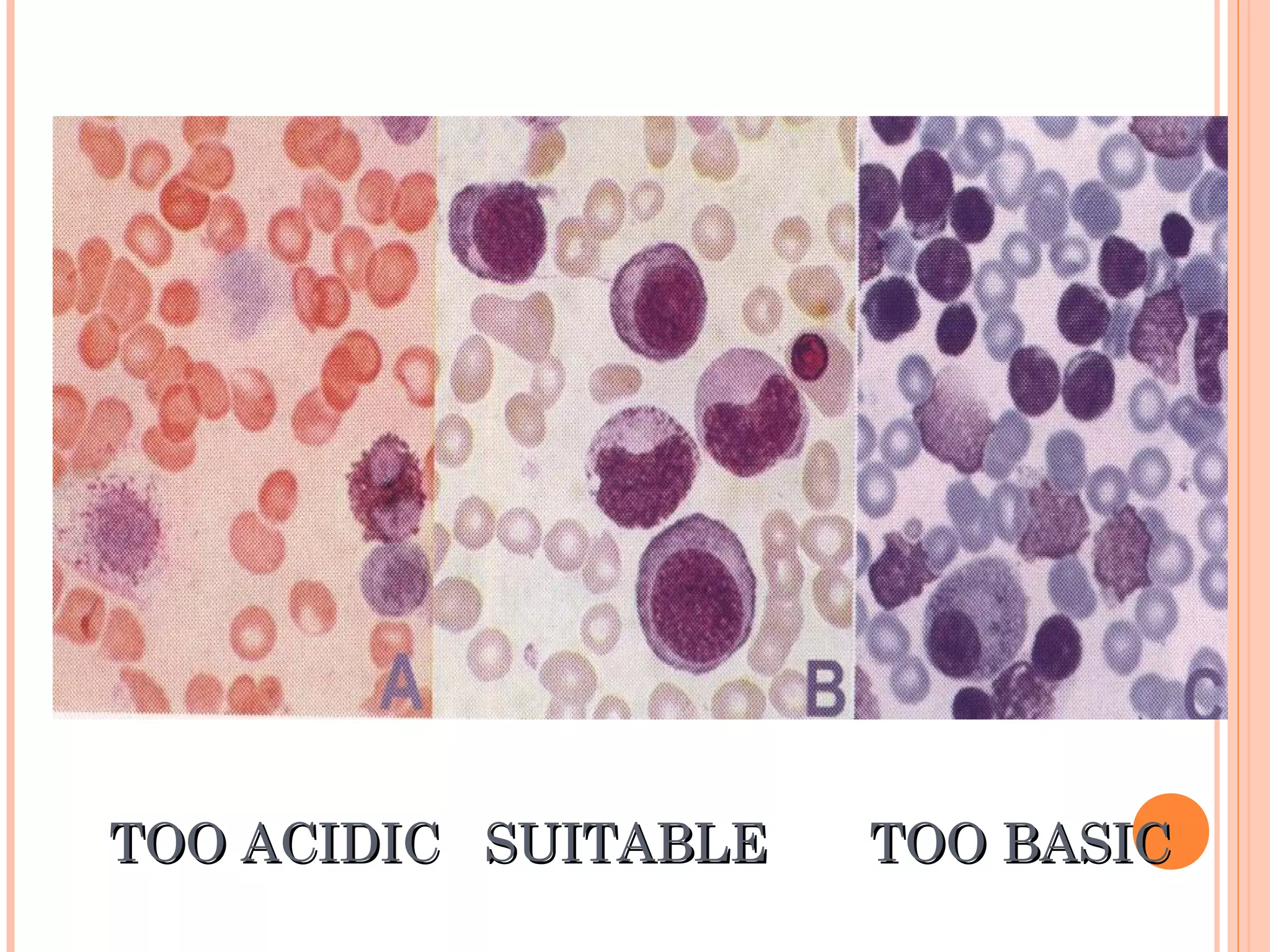 Peripheral blood Smear Preparation | PPT