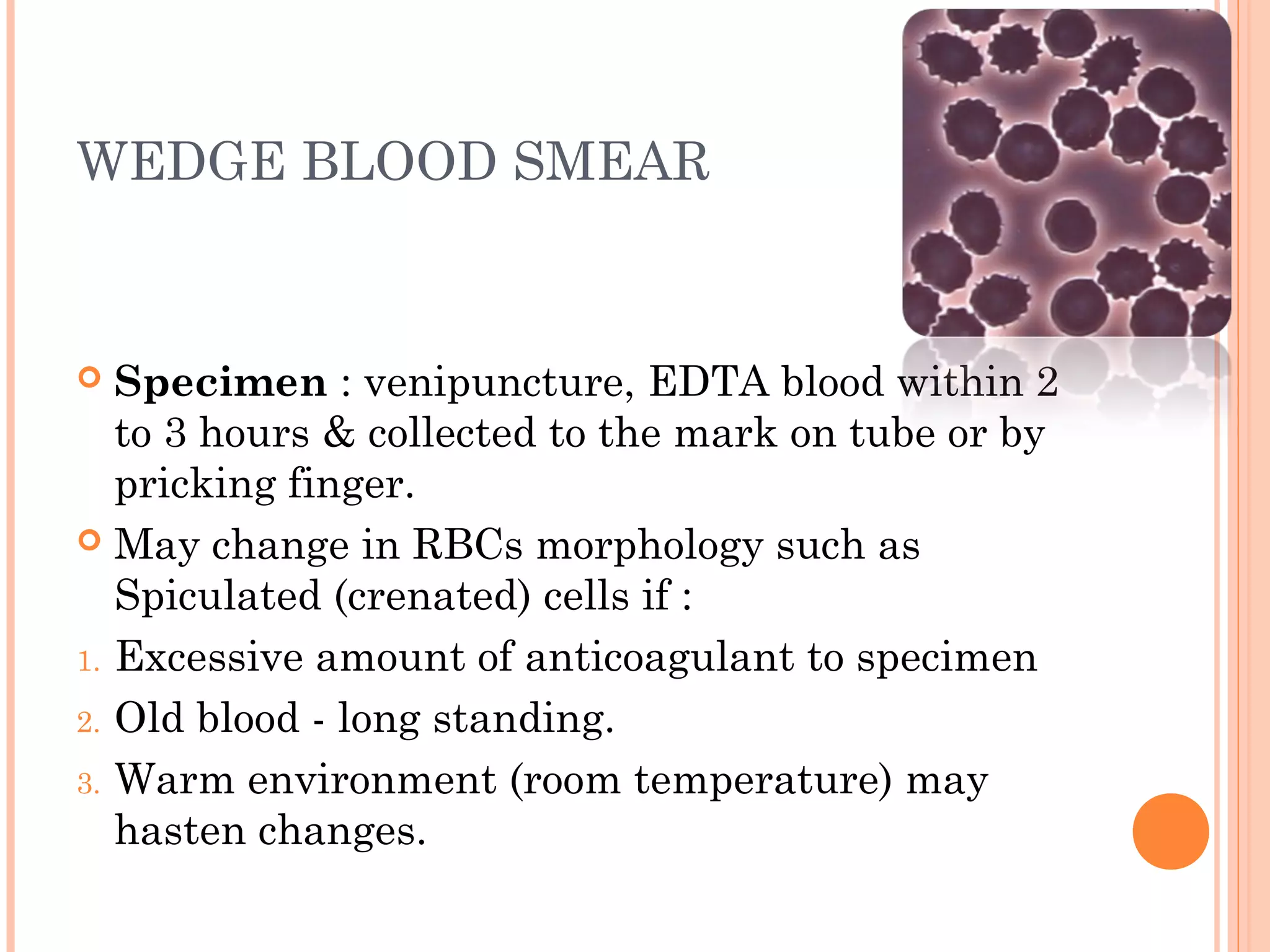 Peripheral blood Smear Preparation | PPT Peripheral blood Smear Preparation | PPT