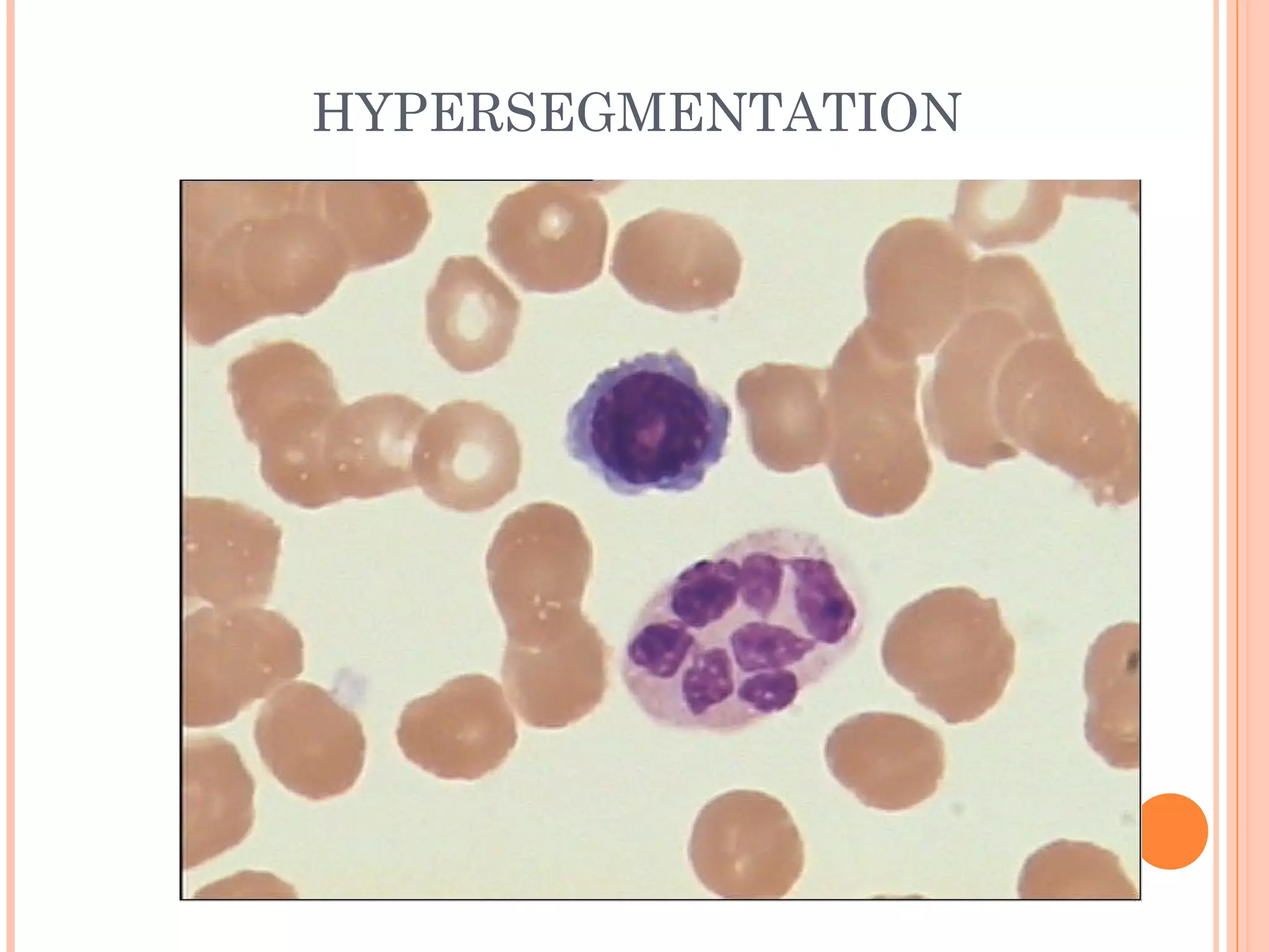 Peripheral blood Smear Preparation | PPT