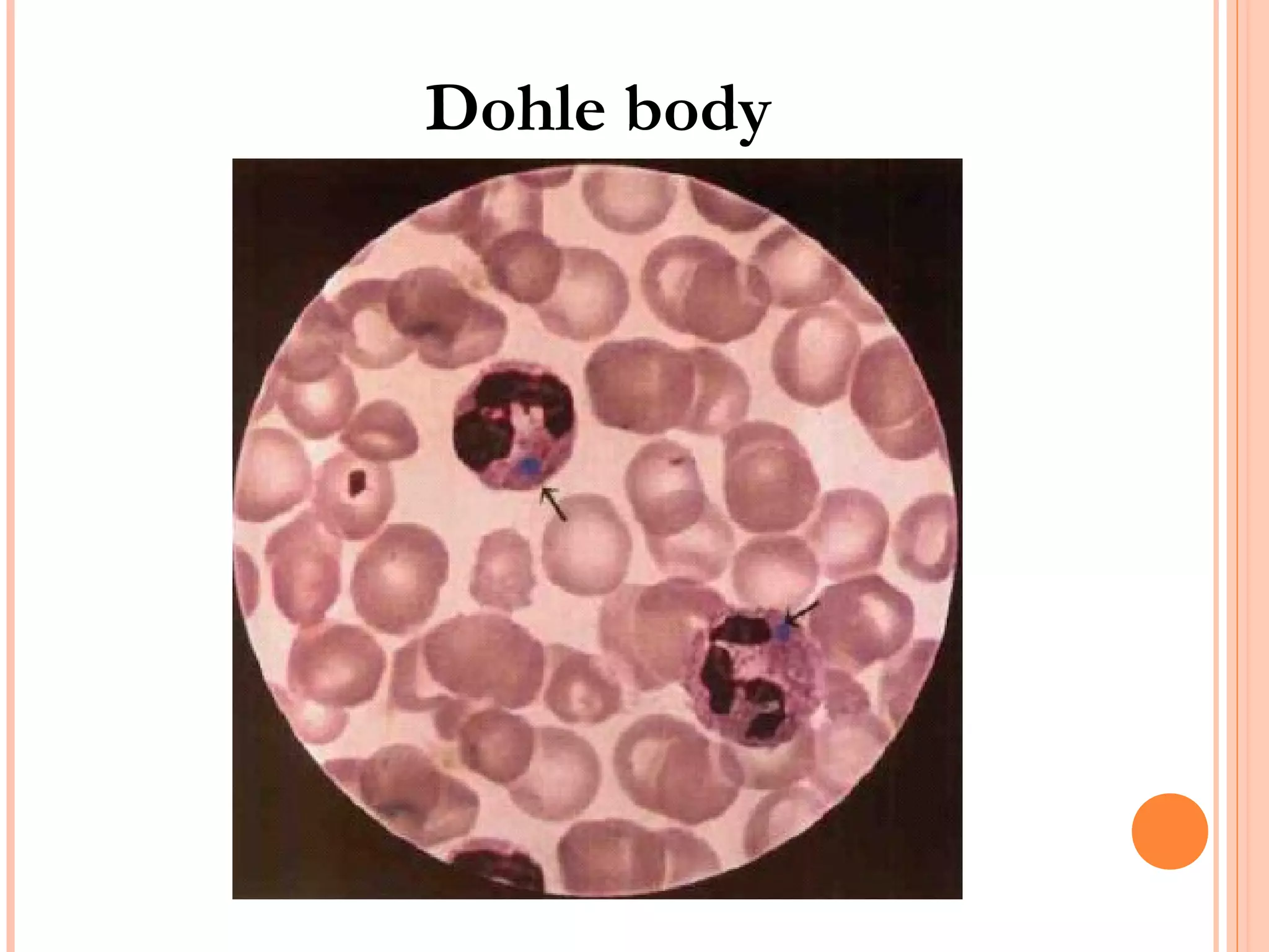 Peripheral blood Smear Preparation | PPT