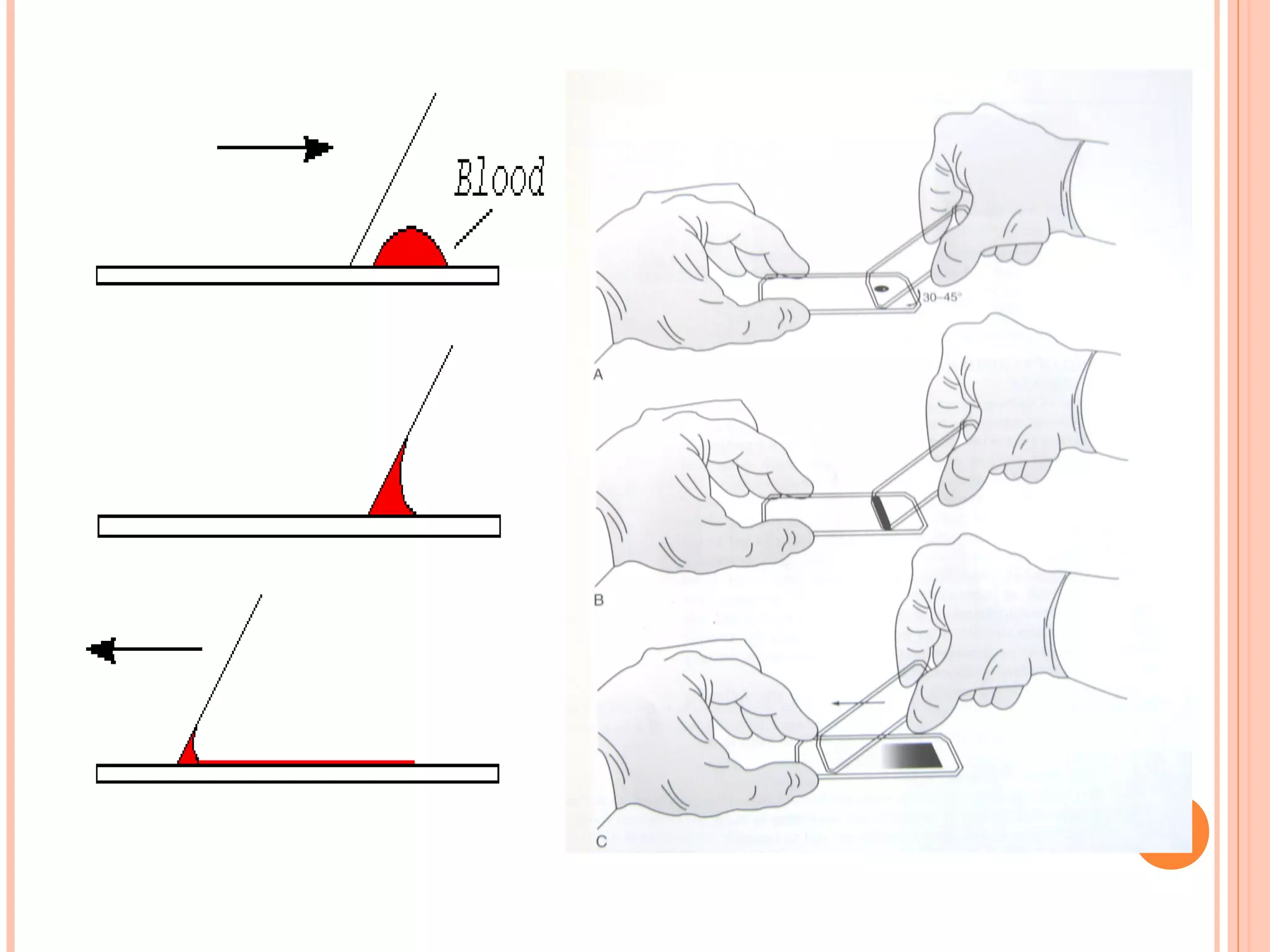 Peripheral blood Smear Preparation | PPT