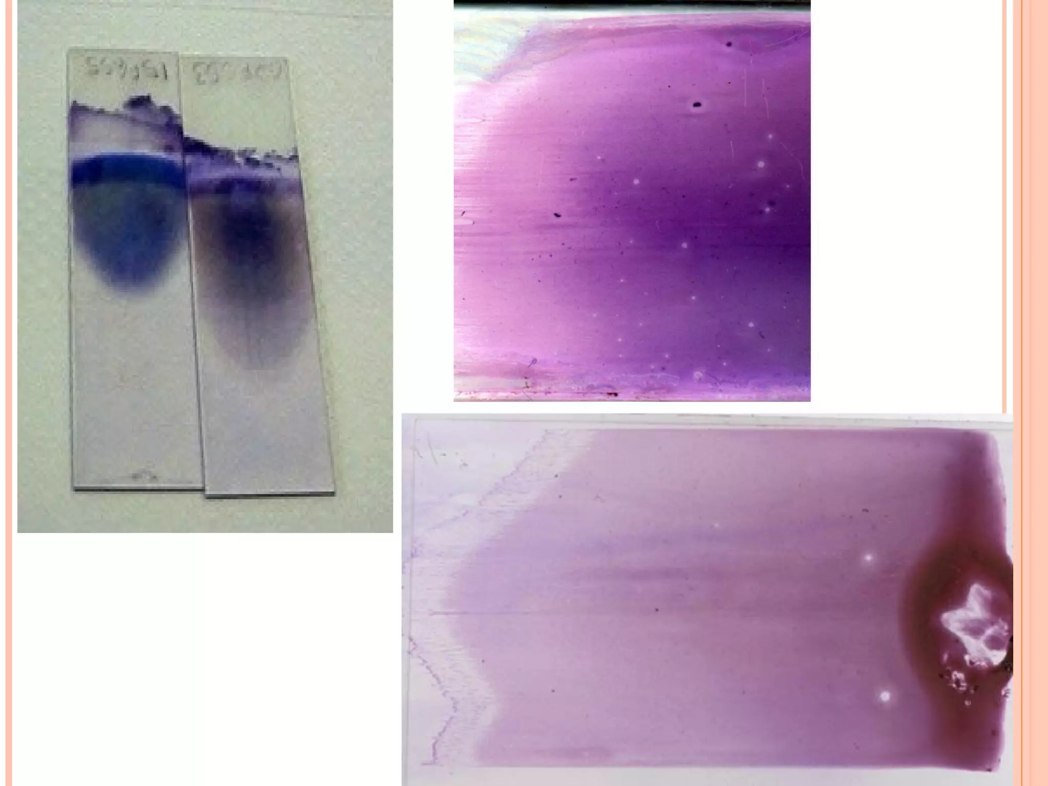 Peripheral blood Smear Preparation | PPT