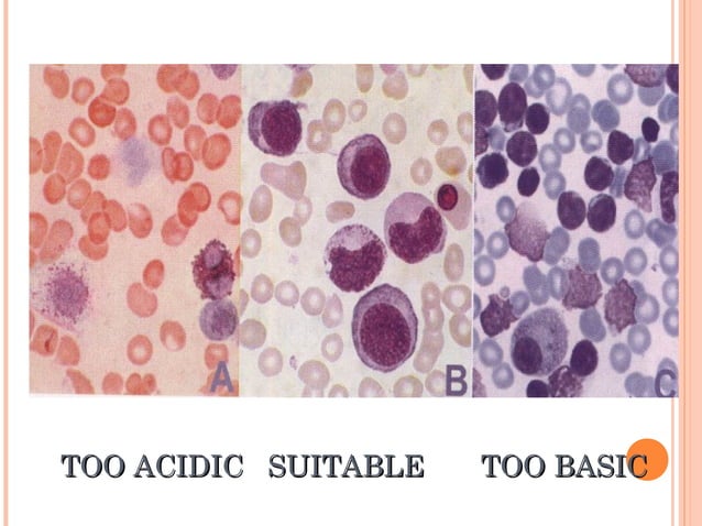 Peripheral blood Smear Preparation | PPT | Blood Disorders | Diseases ...