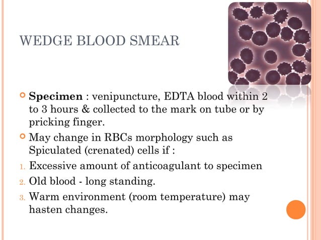 Peripheral blood Smear Preparation | PPT | Blood Disorders | Diseases ...