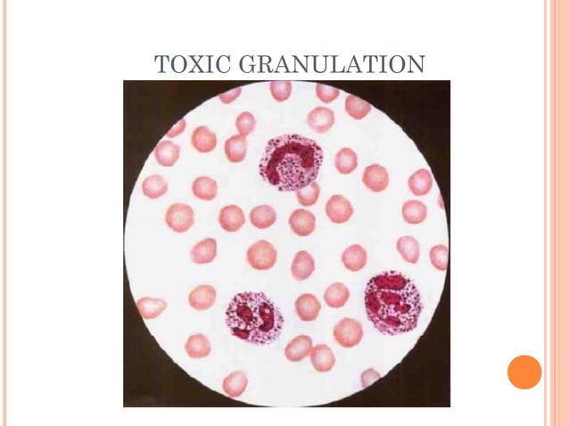 Peripheral blood Smear Preparation | PPT | Blood Disorders | Diseases ...