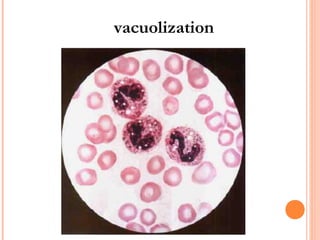 Peripheral blood Smear Preparation | PPT