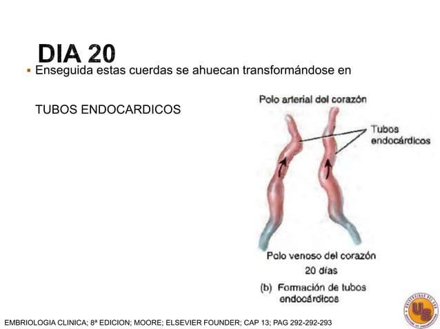 PERSISTENCIA DEL CONDUCTO ARTERIOSO | PPTX