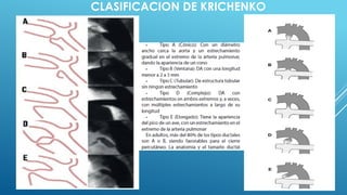 persistencia de conducto arterioso arterial | PPTX