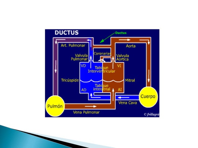 Persistencia del conducto arterioso | PPT