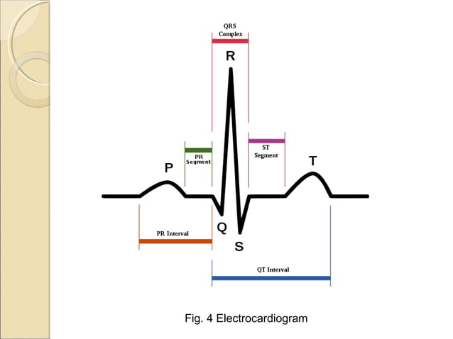 Pca and kpca of ecg signal | PPT | Heart and Cardiovascular Diseases ...