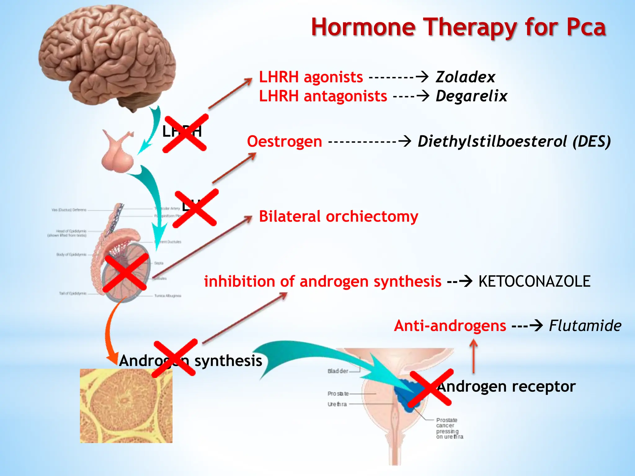pca prstate cancer management ppt.pptx