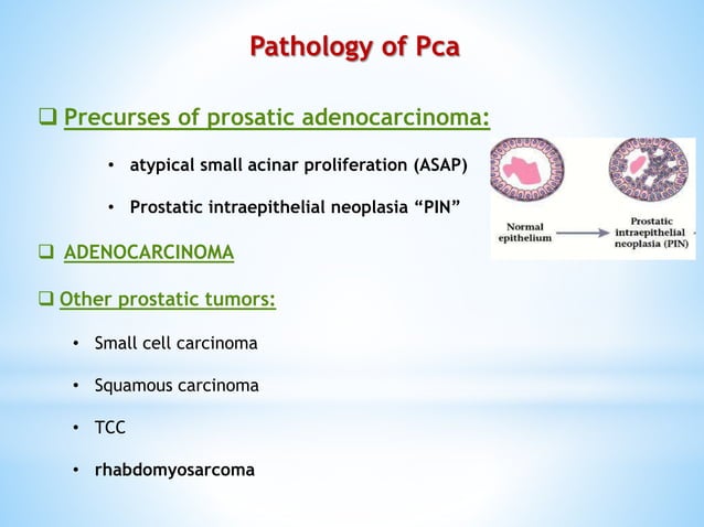 pca prstate cancer management ppt.pptx