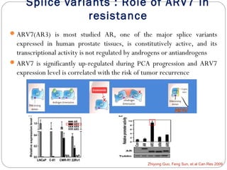 ARV7 splice variant in CRPC | PPT | Cancer | Diseases and Conditions
