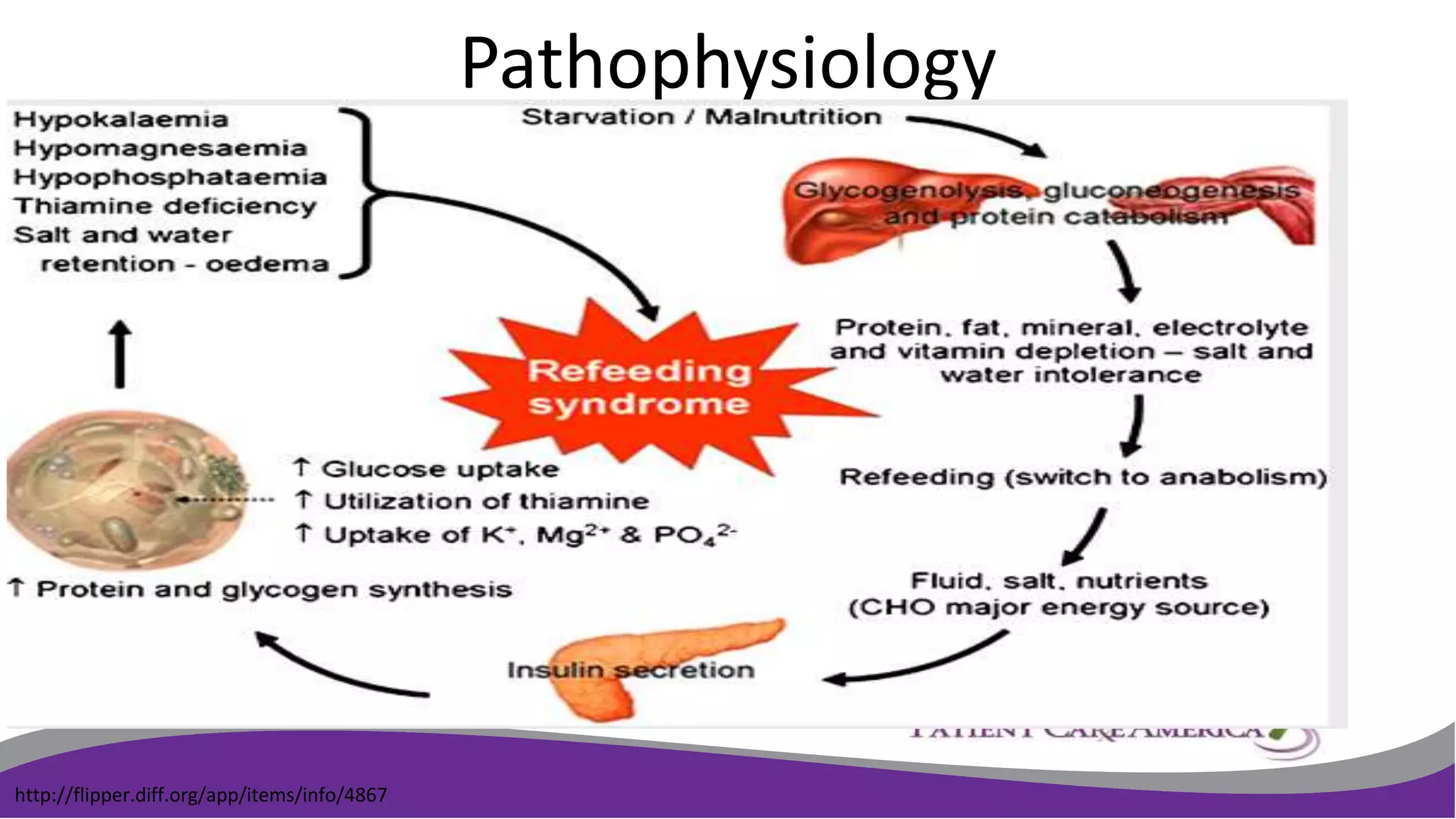 Refeeding syndrome with Parenteral Nutrition in ESRD | PPTX