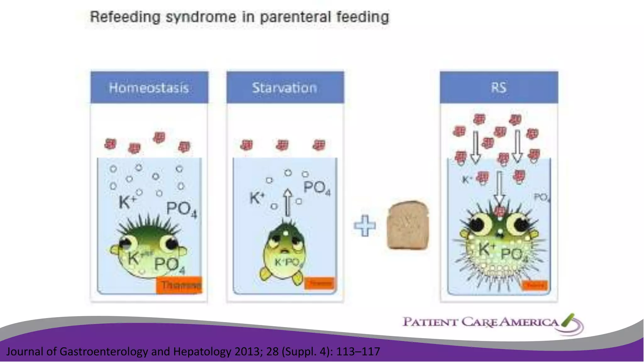 Refeeding syndrome with Parenteral Nutrition in ESRD | PPTX