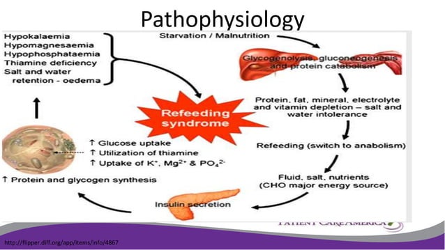 Refeeding syndrome with Parenteral Nutrition in ESRD | PPTX | Endocrine ...