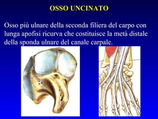 Pseudoartrosi congenita dell'apofisi unciforme dell'osso uncinato | PPT