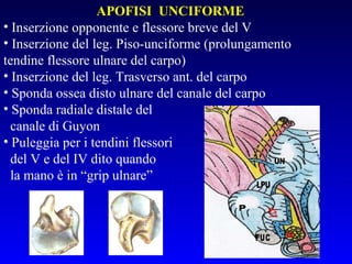 Pseudoartrosi congenita dell'apofisi unciforme dell'osso uncinato | PPT