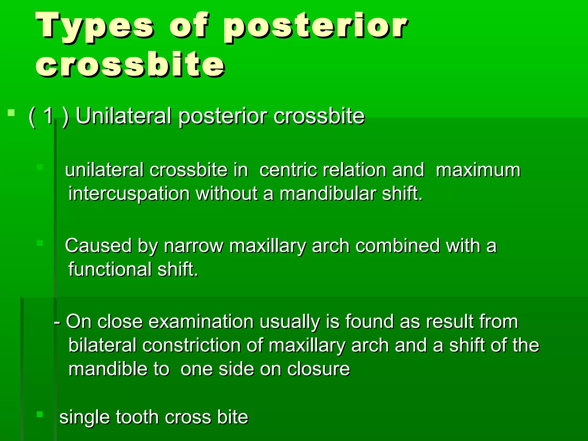 Posterior Crossbite | PPT