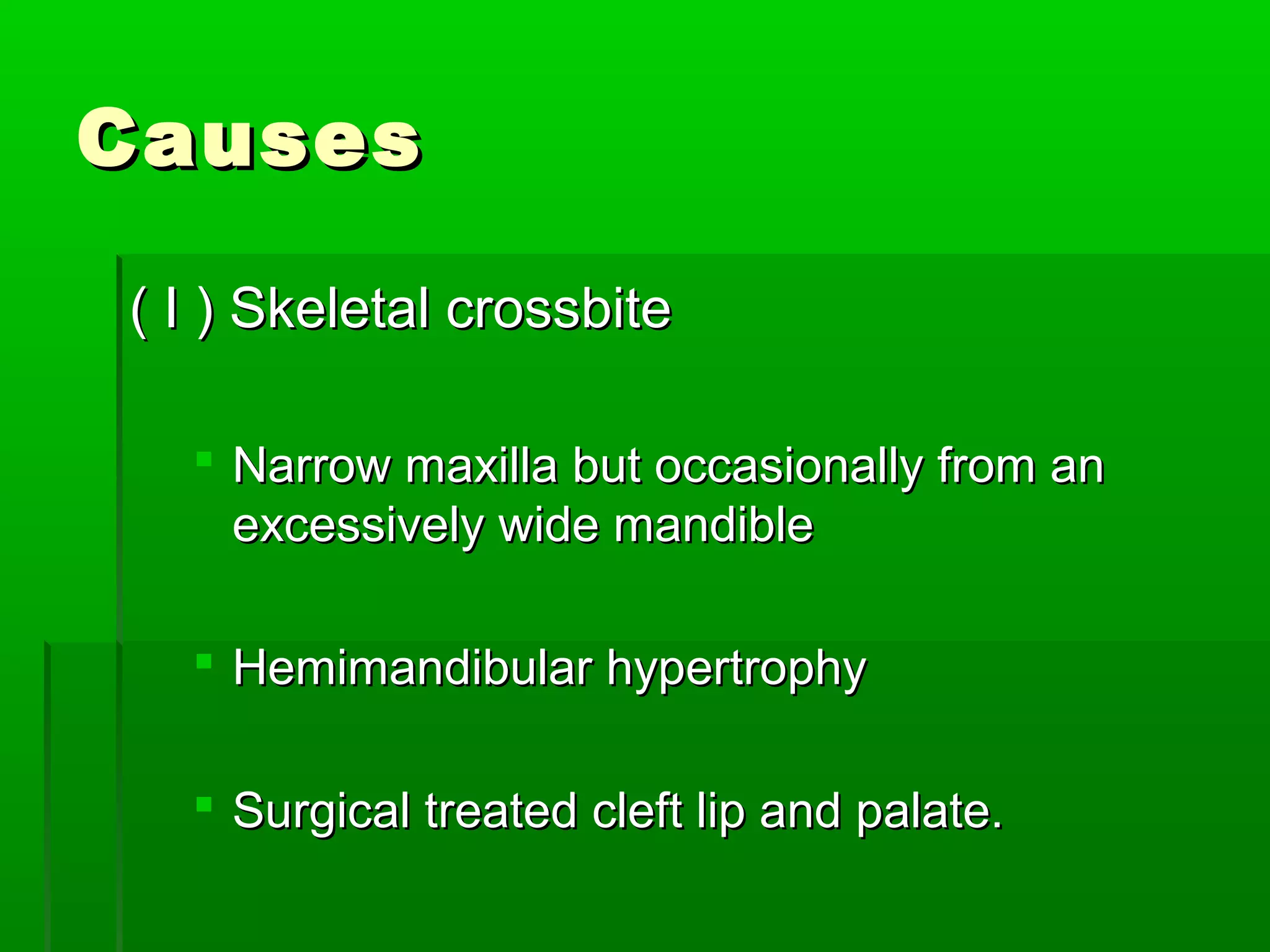 Posterior Crossbite | PPT