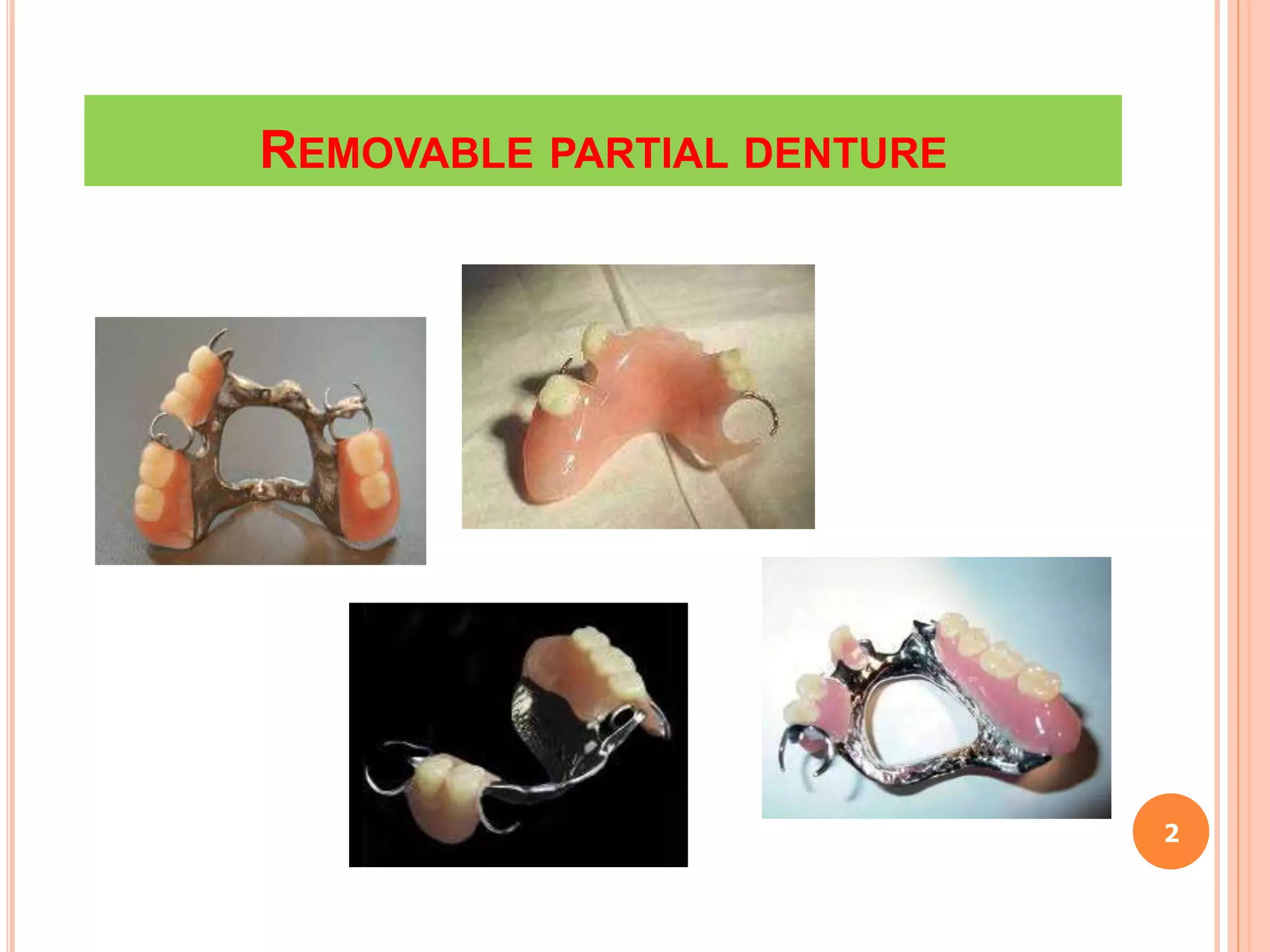Surveying and Designing in Cast Partial Denture | PPT