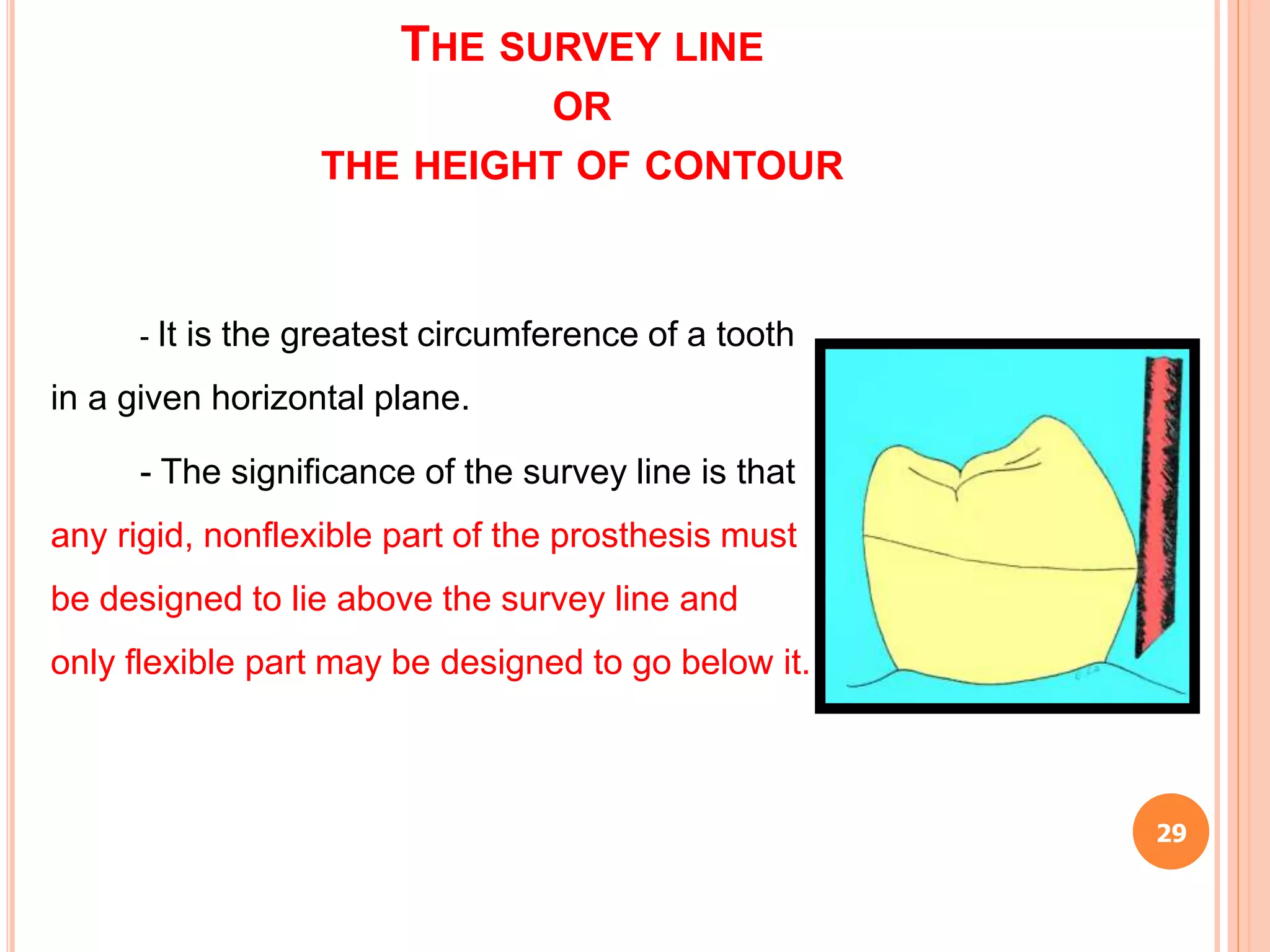 Surveying and Designing in Cast Partial Denture | PPT