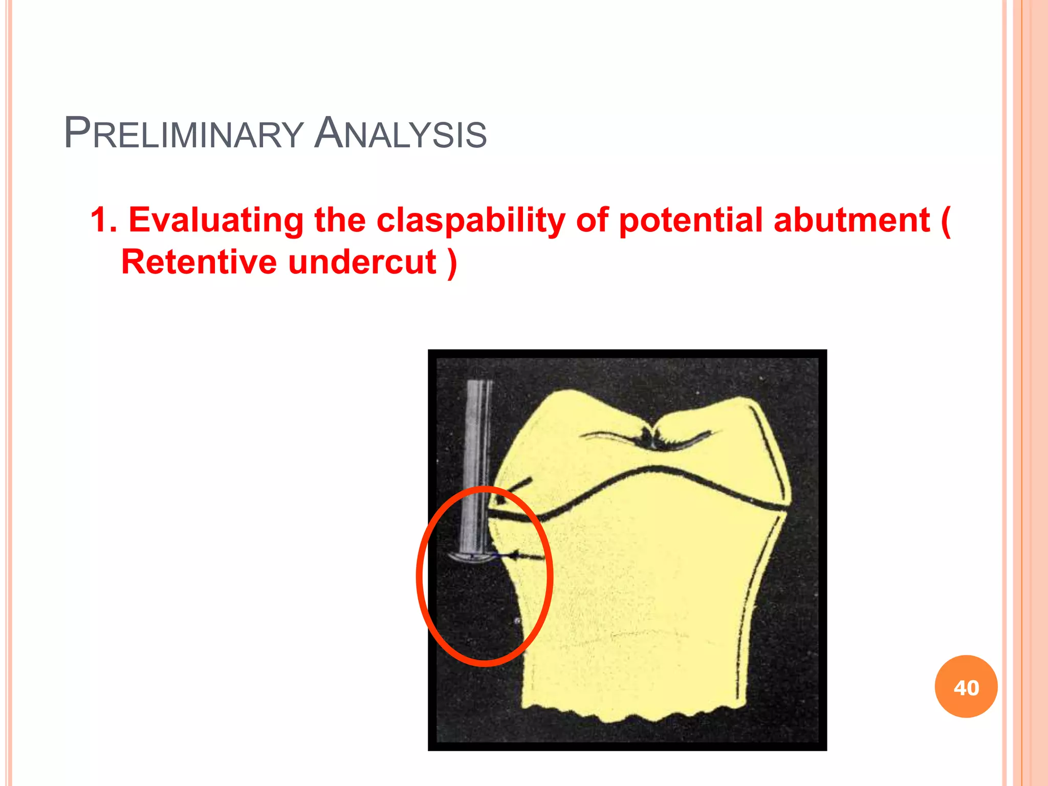 Surveying and Designing in Cast Partial Denture | PPT