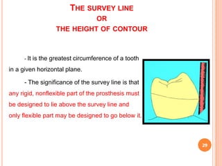 Surveying and Designing in Cast Partial Denture | PPT