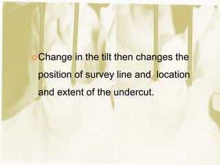 Surveying and Designing in Cast Partial Denture | PPT