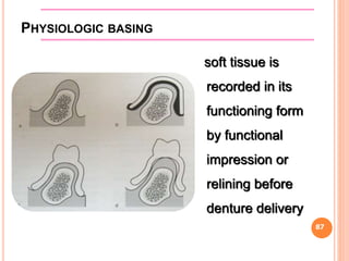 Surveying and Designing in Cast Partial Denture | PPT