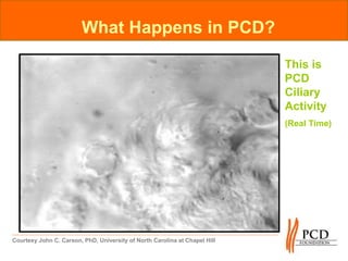 Pcd presentation mpls | PPT