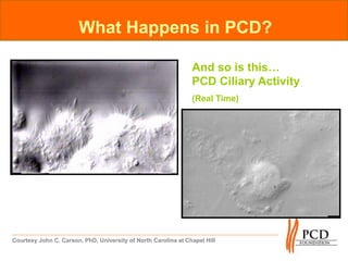Pcd presentation mpls | PPT