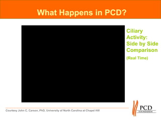 Pcd presentation mpls | PPT