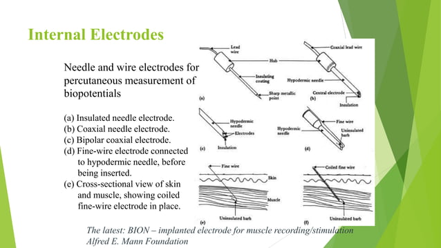 Phonocardiography(PCG) | PPTX