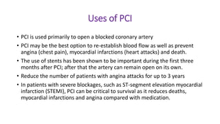 Percutaneous Coronary Intervention | PPTX