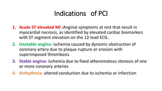 perceptions of PCI | PPT