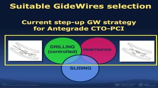 CTO PCI: Wire Seelection | PPTX | Heart and Cardiovascular Diseases ...