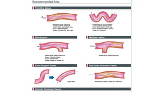 CTO PCI: Wire Seelection | PPTX